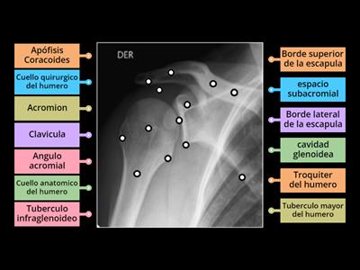 Superior Anatomia hombro - Recursos didácticos