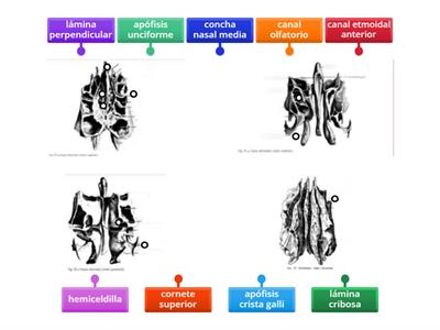 Hueso etmoides - Recursos didácticos