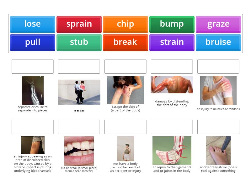 6B Vocabulary: Injuries - Match up