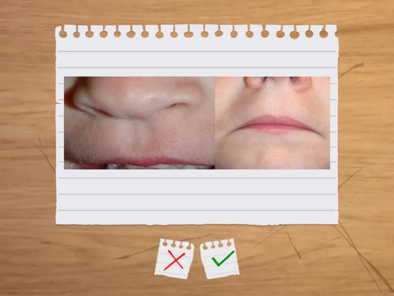 Nariz, filtrum - Tarjetas flash