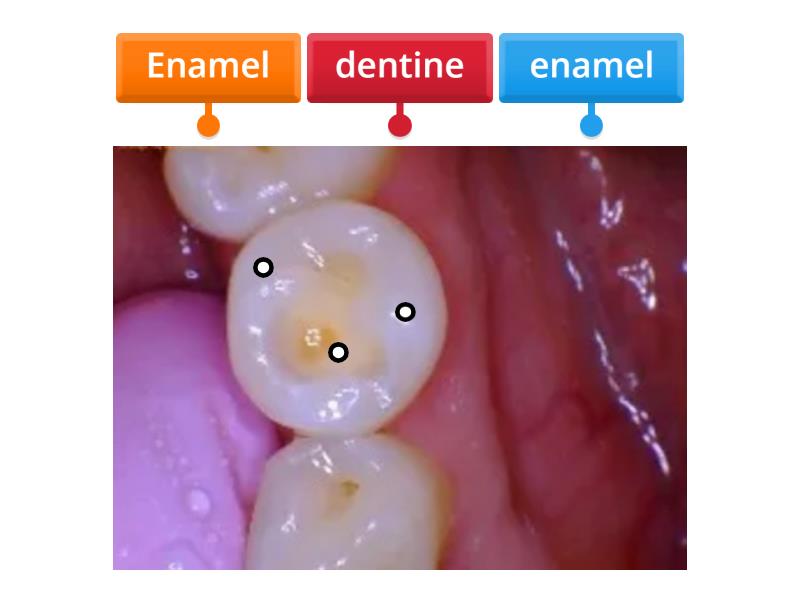 dentine and enamel colours - Labelled diagram