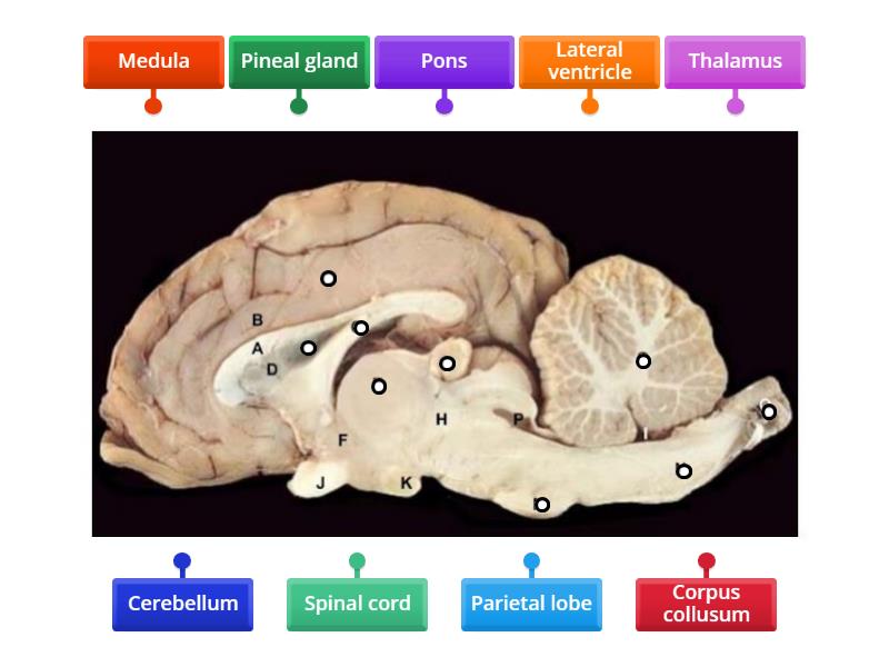 Sheep brain - Labelled diagram