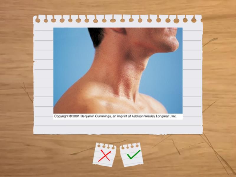 EF Intermediate. Parts of the Body - Flashcards