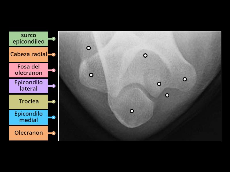 Anatomia rx proyeccion de olecranon - Diagrama con etiquetas