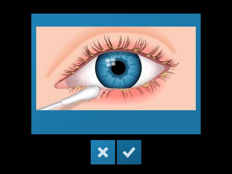 pain, ache, sore, hurt - Flash cards