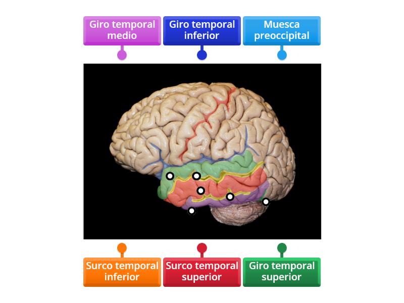 Lobulo temporal - Diagrama con etiquetas