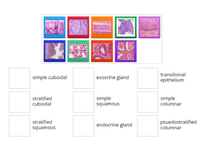 epithelial tissues matching pictures - Match up