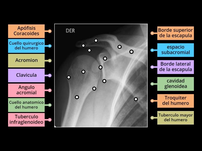 Anatomia de rx Hombro - Labelled diagram