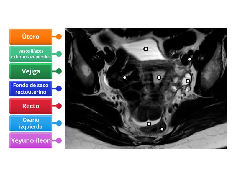 Relaciones de útero - Labelled diagram
