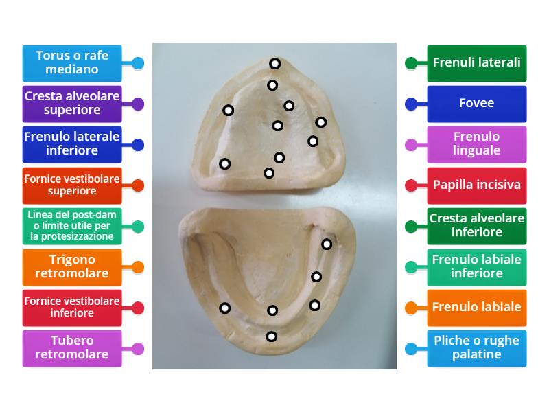 Anatomia del modello edentulo - Diagrama con etiquetas