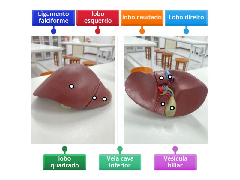 Figado 1 - Labelled diagram