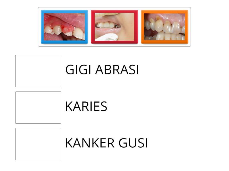 PENYAKIT GIGI - Match up