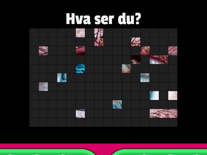 Kroppen - Bildequiz - Image quiz