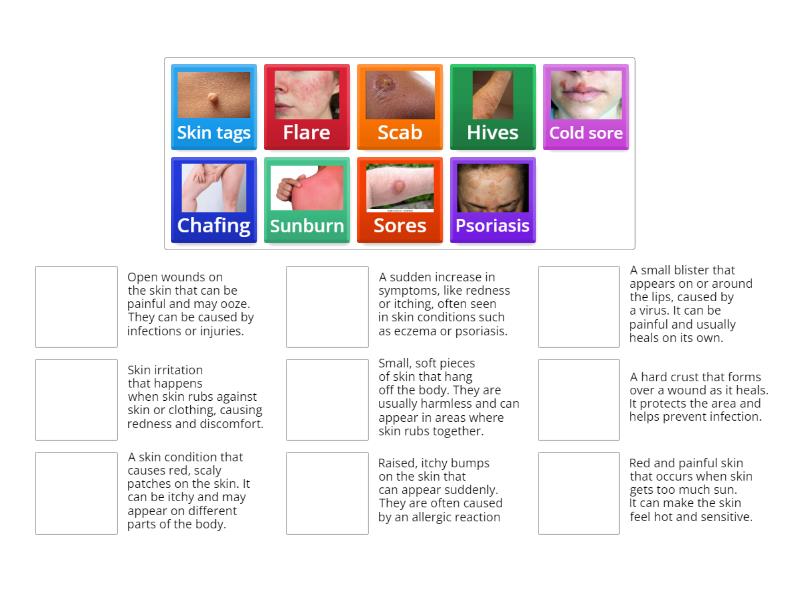 Skin conditions - Match up