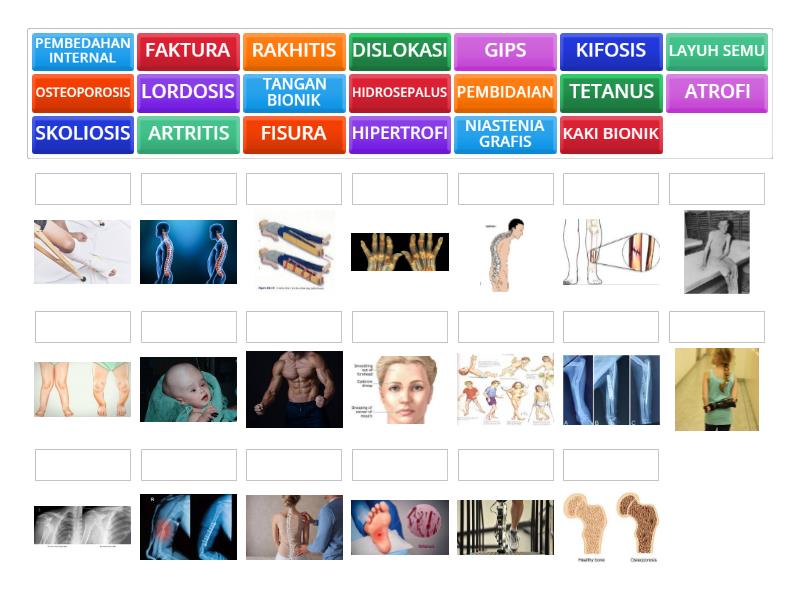 GANGGUAN DAN TEKNOLOGI SISTEM GERAK - Associação