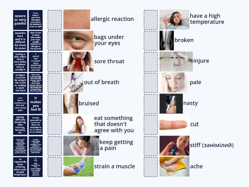 B1+ RM 7A Voc - Match up