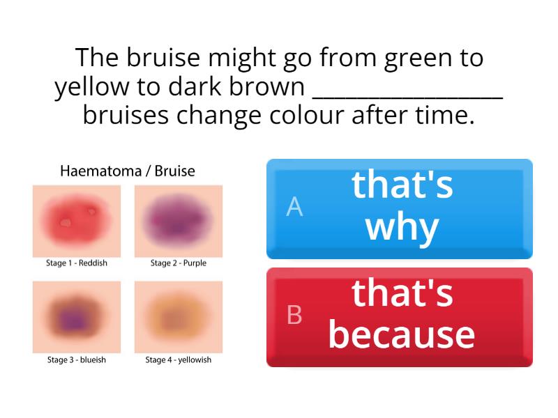 OW4 U4 That's why, because bruises and bumps - Quiz