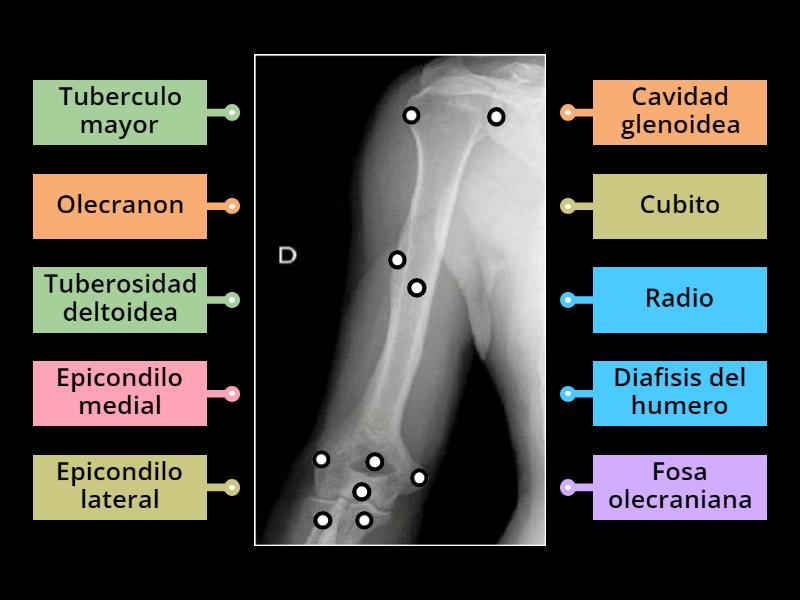 Anatomia rx humero ap - Diagrama con etiquetas