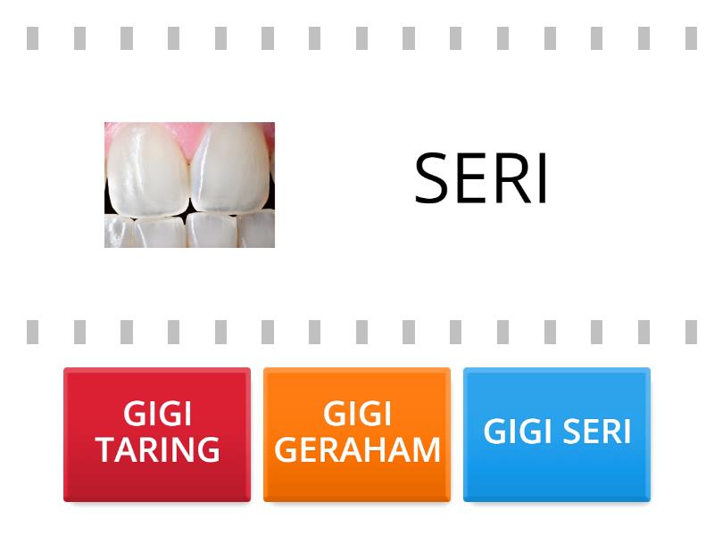 APA SAJA JENIS JENIS GIGI - Find the match