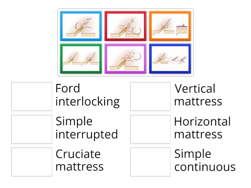 Suture patterns - Match up