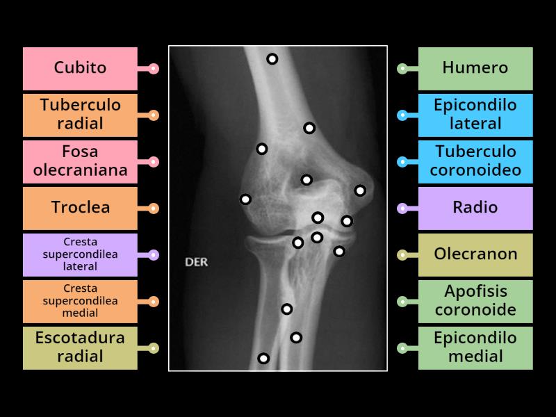 Anatomia rx codo ap - Diagrama con etiquetas