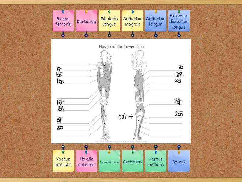 Ant, Pos Leg - Labelled diagram