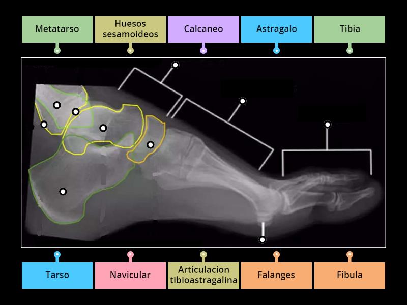 Rx anatomia pie lateral (sin carga) - Labelled diagram Rx anatomia pie lateral (sin carga) - Labelled diagram