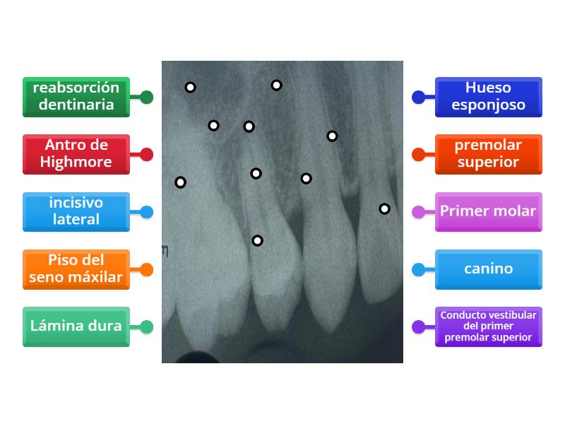 Premolar Superior izquierdo - Diagrama con etiquetas