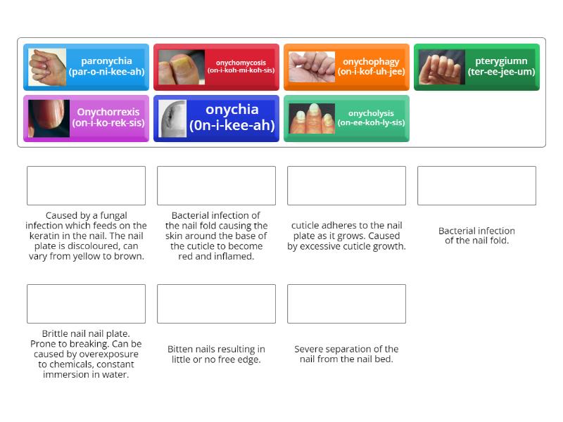 Manicure nail conditions and contra-indications - Match up
