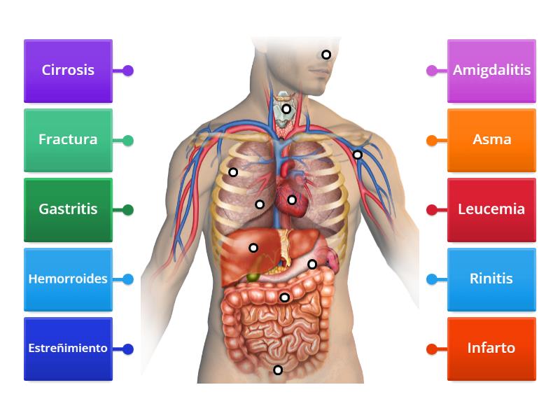 Enfermedades del cuerpo humano - Diagrama con etiquetas