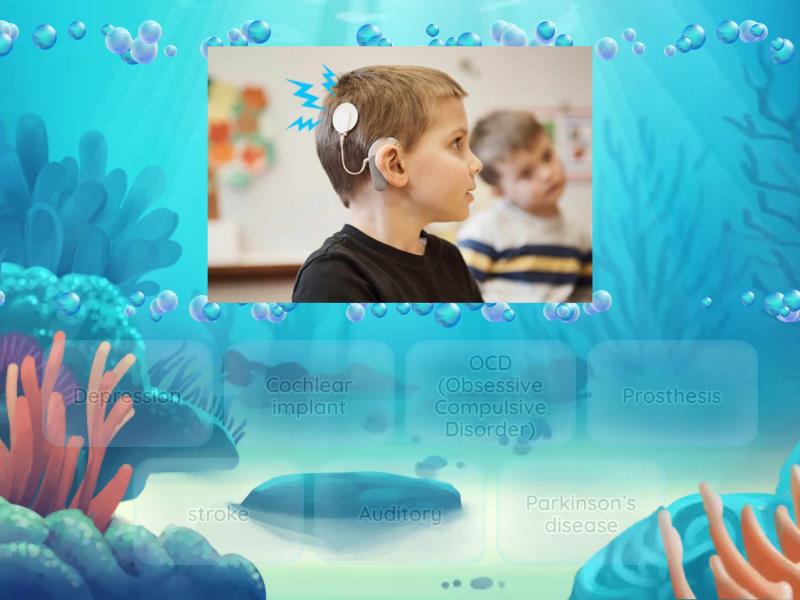 Are Bionic Superhumans on the Horizon? 2 - Cada oveja con su pareja