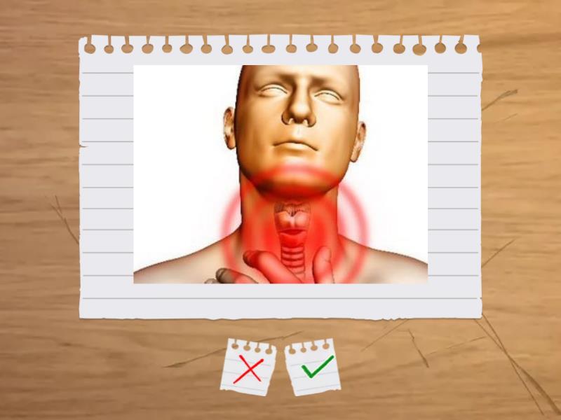 How are you feeling? I'm sick! (pain and illnesses) - Flash cards