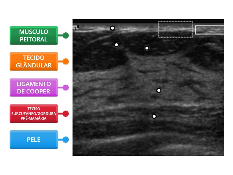 ANATOMIA MAMA - Labelled diagram