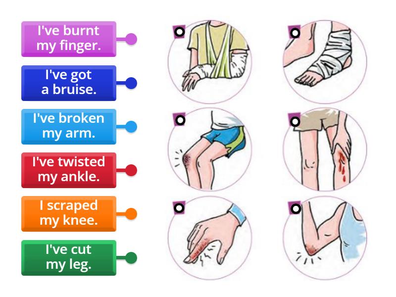 Injuries 4 - Labelled diagram