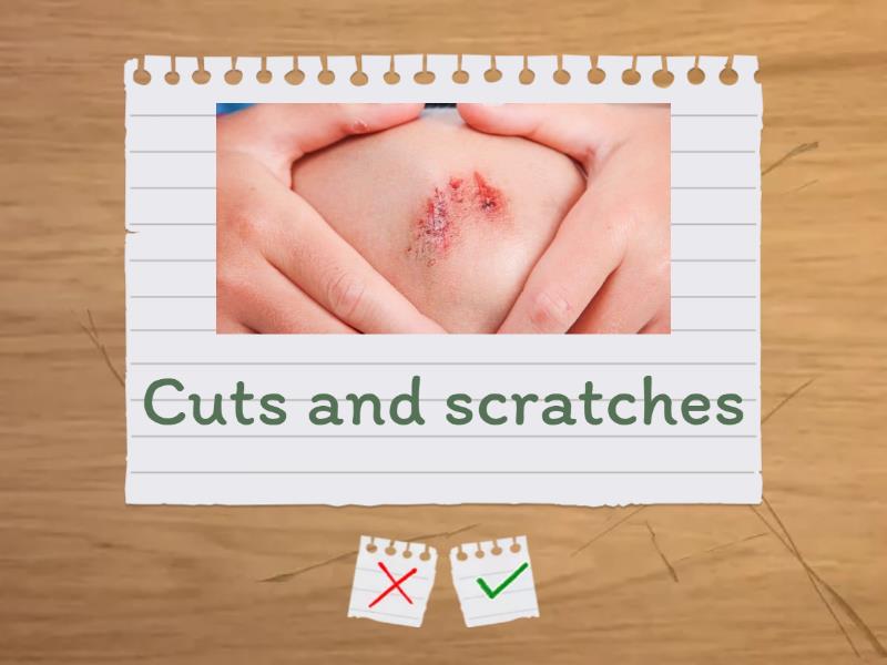 First Aid treatment for common injuries - Flash cards