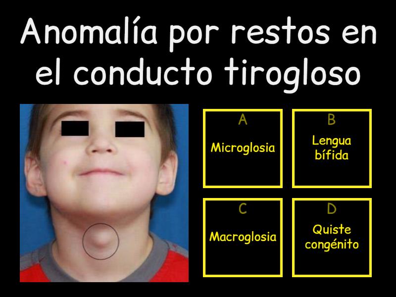 Anomalías de Lengua y Paladar - Quiz