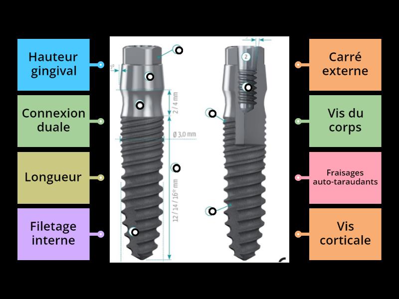 Implant - Labelled diagram