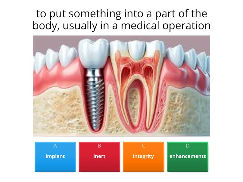 Are Bionic Superhumans on the Horizon? - Quiz