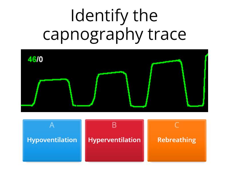 Anaesthesia Monitoring Quiz