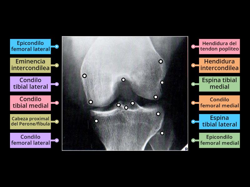 Anatomia rx tunel intercondilio rodilla - Labelled diagram
