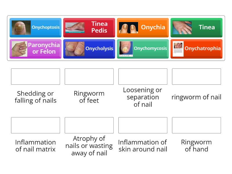 Nail Diseases - Match up