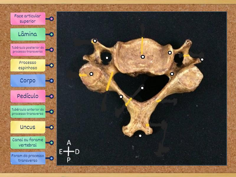 Anatomia VÉRTEBRA TÍPICA - CERVICAL - Labelled diagram