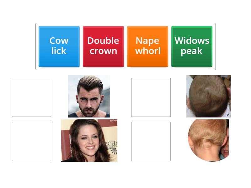 Hair growth patterns - Match up