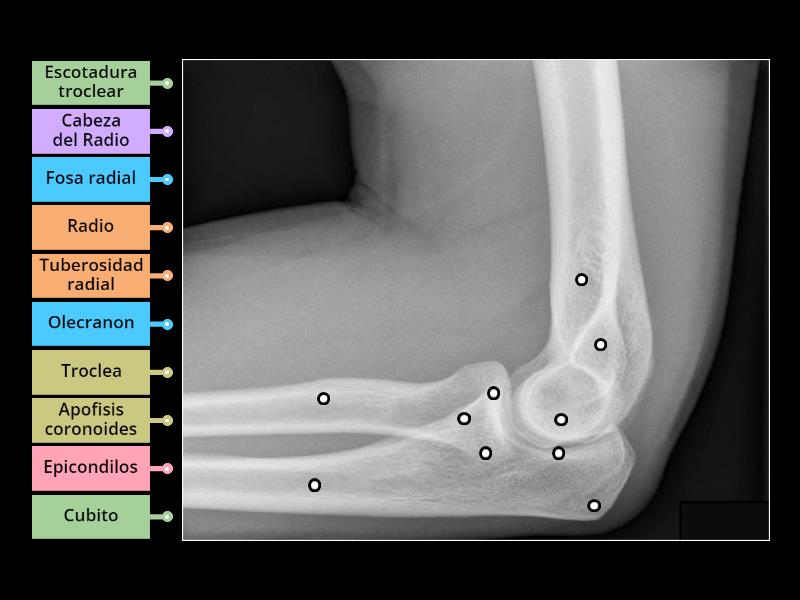 Anatomia Rx Codo lateral - مخطط المربعات