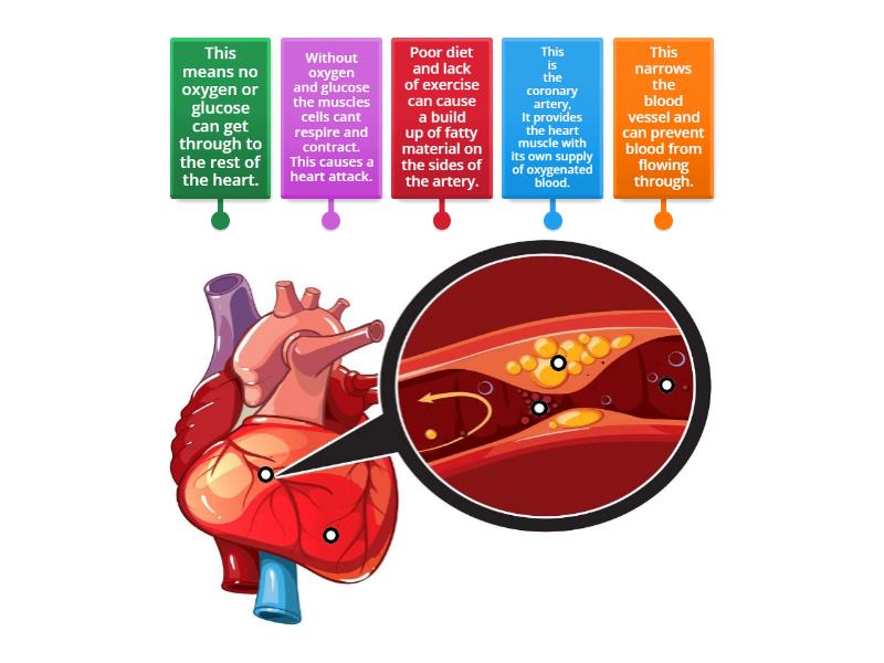 CHD Labelling - Labelled diagram