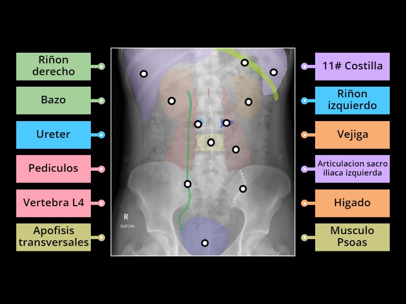 Rx abdomen anatomia - Diagrama con etiquetas