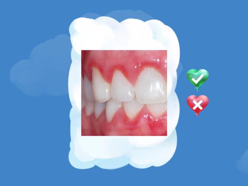 DENTAL FLASHCARD - Flash cards