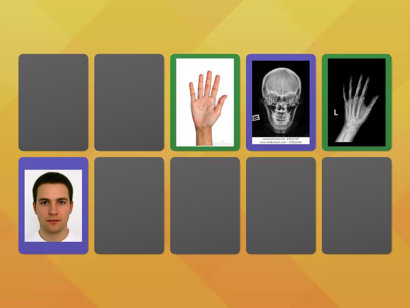 X-ray and Body parts - Matching pairs