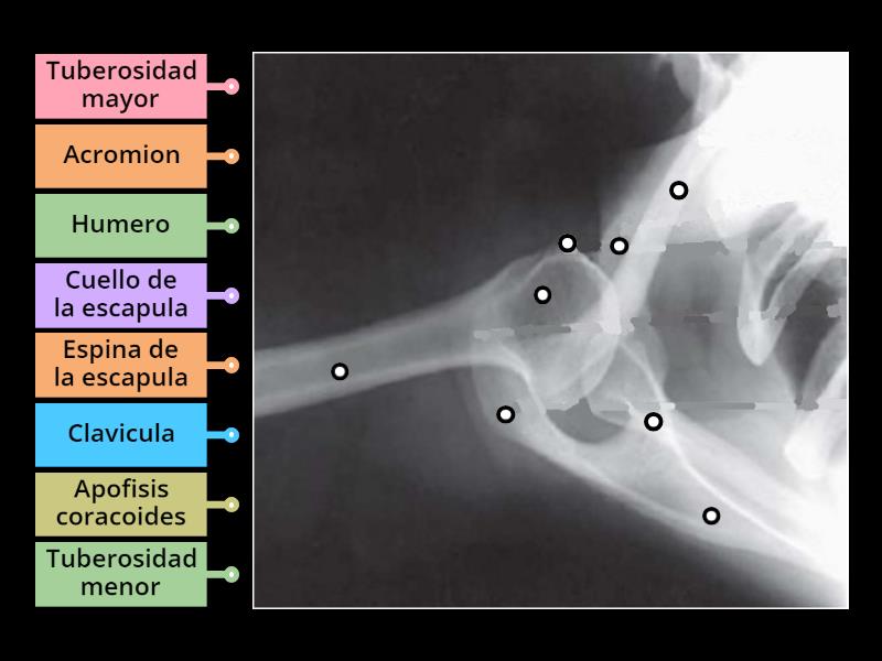 Anatomia rx hombro axial superoinferior - Labelled diagram