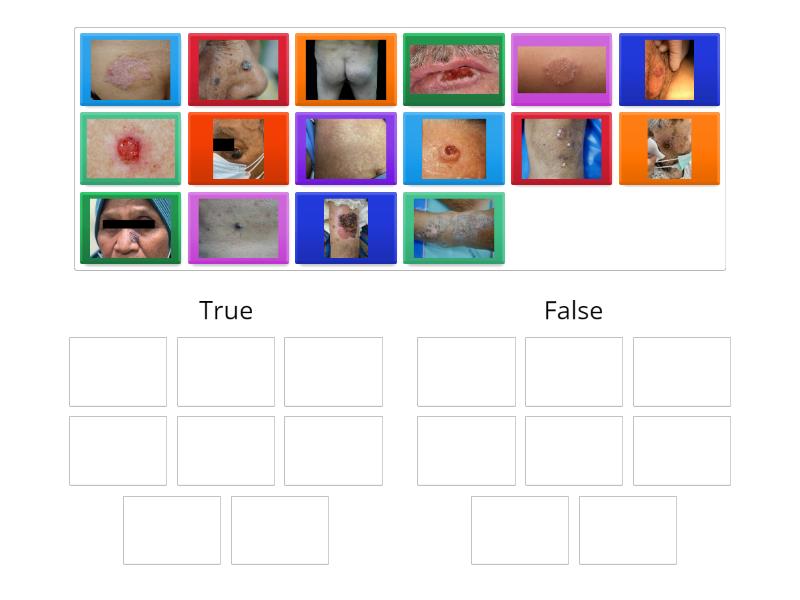 Select the picture that risk of skin cancer into the true box and picture without skin cancer ...
